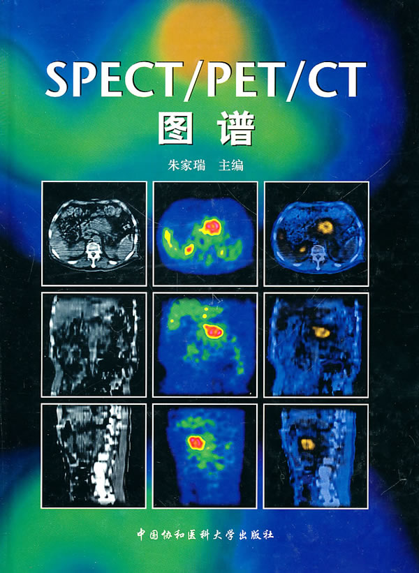 肺癌spect图像,肺t图片,正常肺和肺图片_大山谷图库